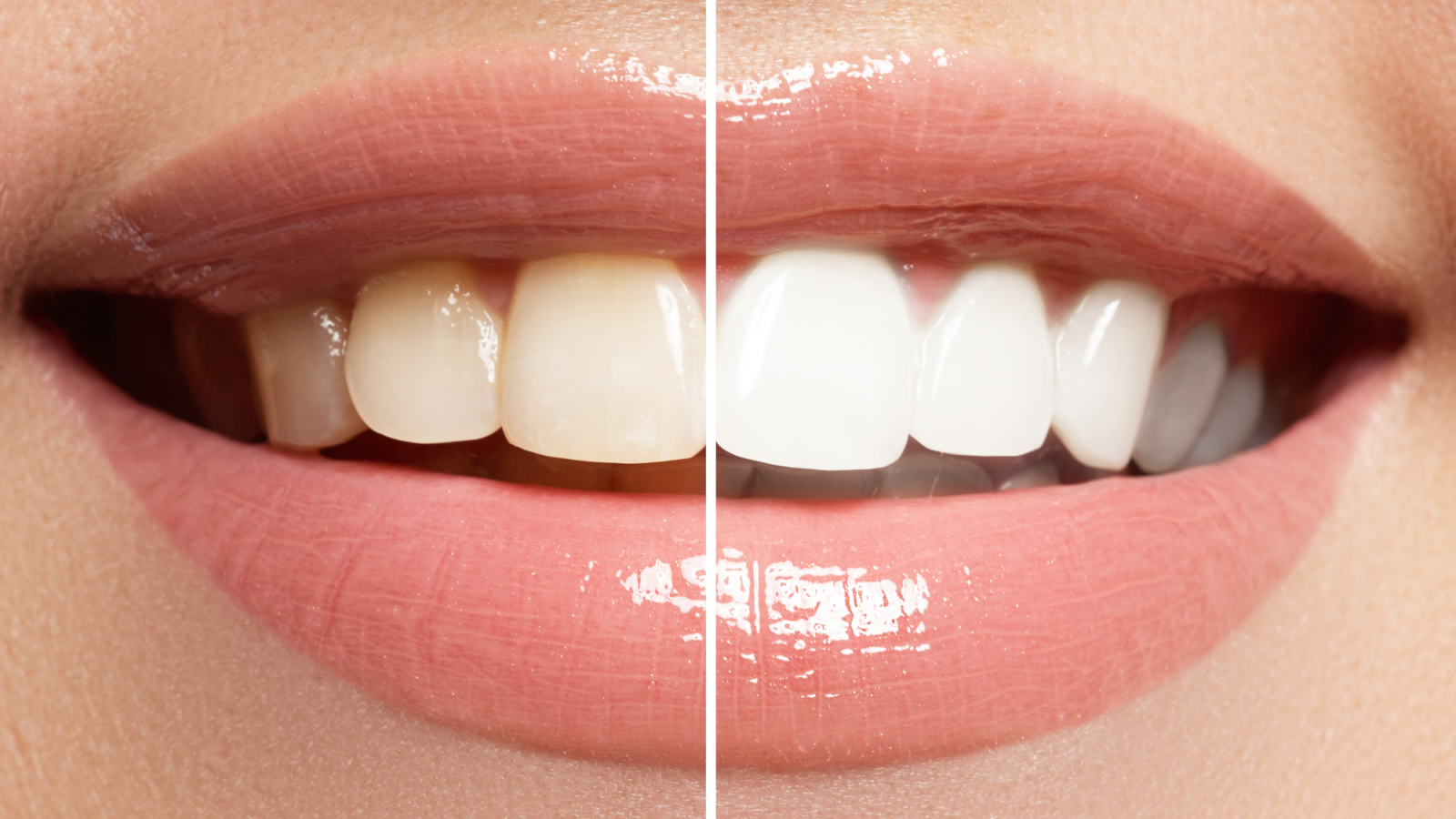 20 tips to keep your teeth pearly white | Yardbarker