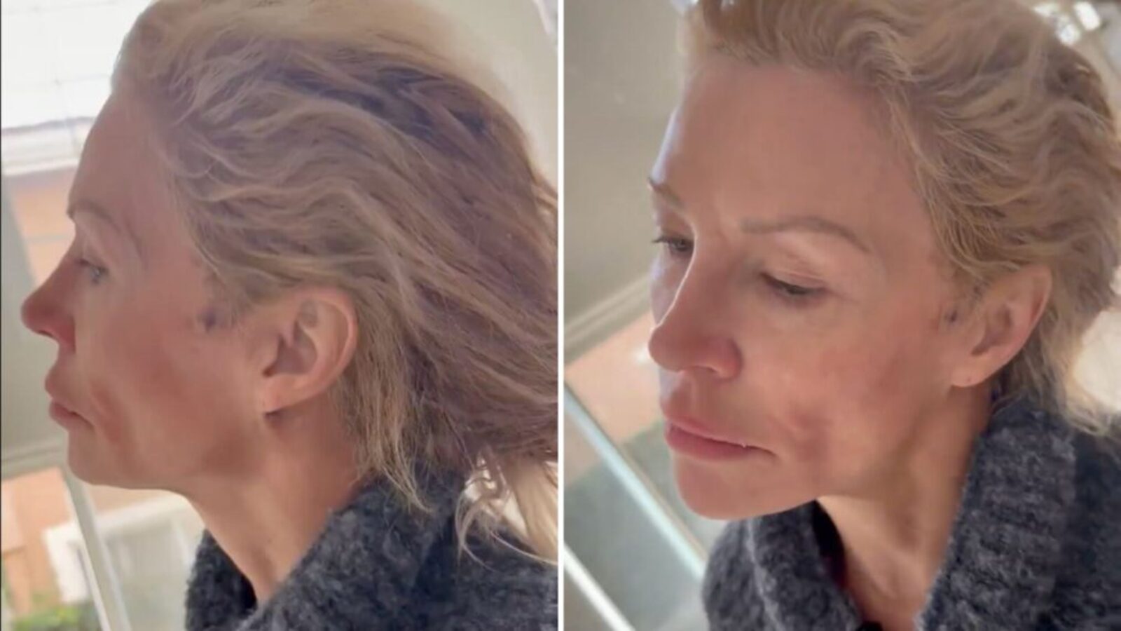 Brandi Glanville Shares ‘Crazy’ Update Amid Treatment for Health Issues ...