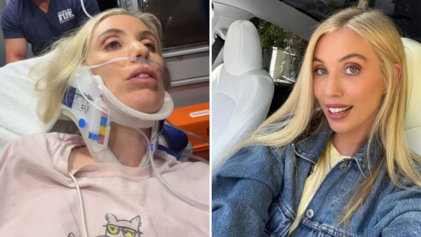 ‘2 Broke Girls’ Actress & Comedian Laura Clery ‘Almost Died’ After ...