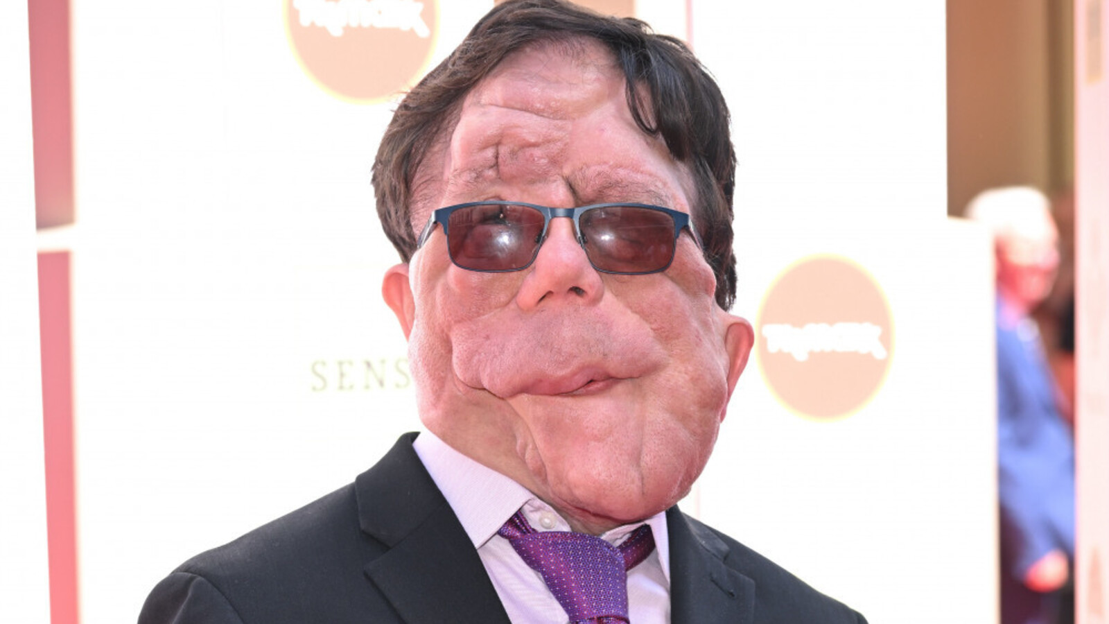 Adam Pearson 'beyond honoured' to star in Elephant Man remake | Yardbarker