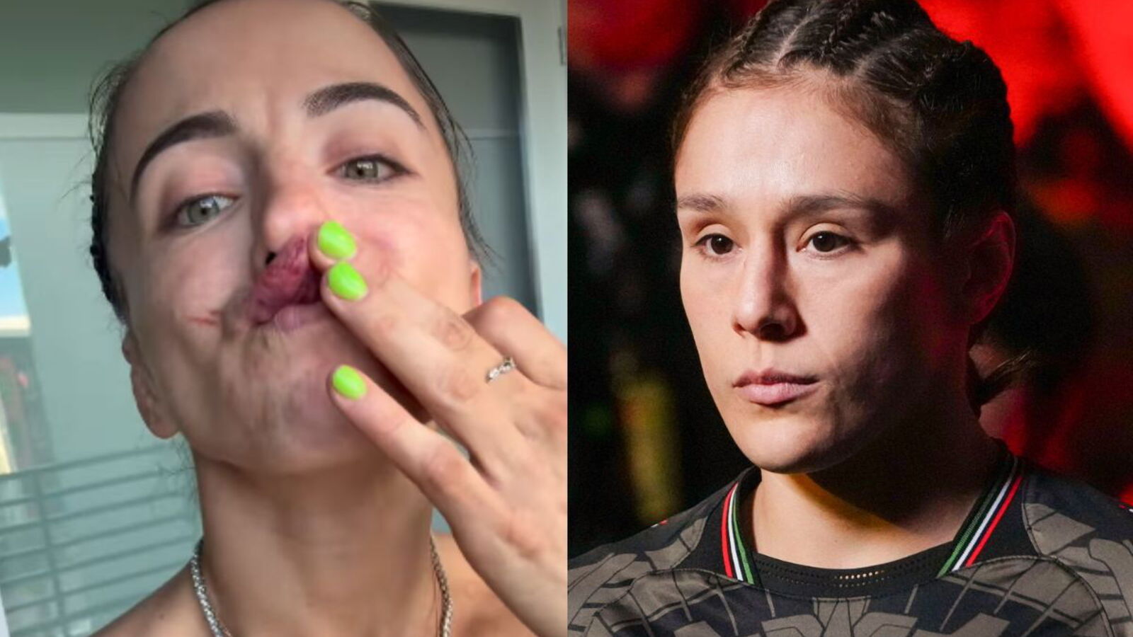 'I Look Like I’m Dead': Maycee Barber Issues Health Update After Alexa ...