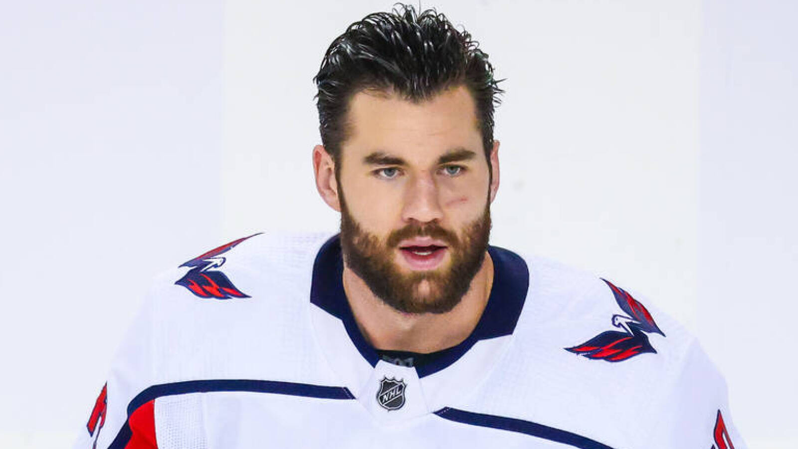 Capitals' Tom Wilson faces lengthy suspension after high-stick incident ...